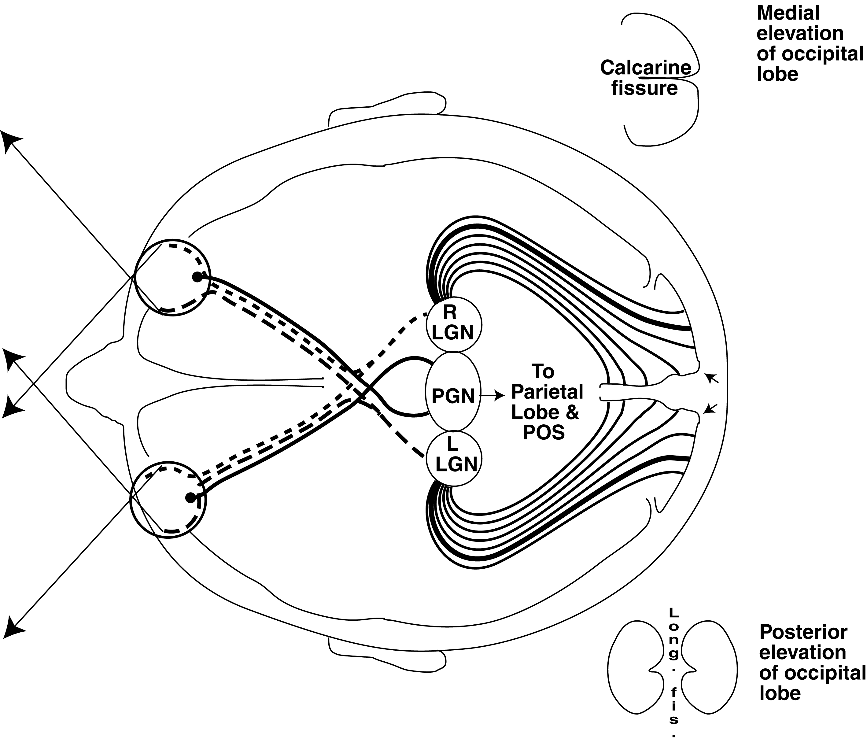 Macular Sparing Versus Foveola Sparing
